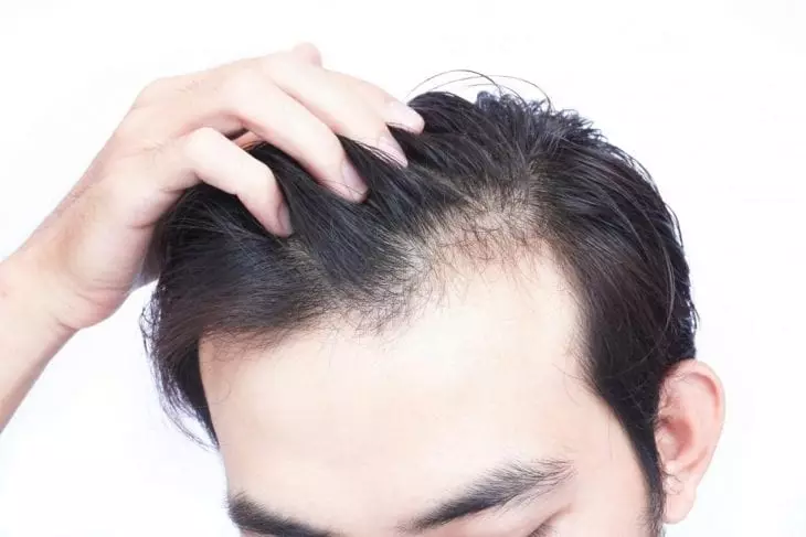 Најдобри начини за спречување на опаѓање на косата 10599_1