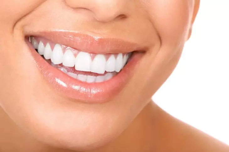 دانتوں کے امپلانٹس آپ کی زندگی میں کیسے فرق ڈال سکتے ہیں۔ 10648_4