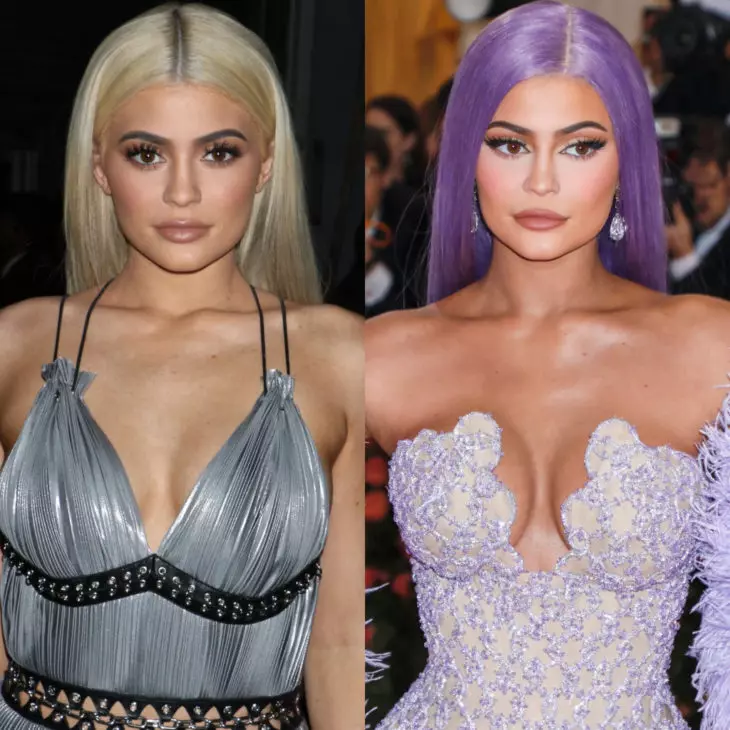 Pekerjaan Payudara yang Dirumorkan Kylie Jenner oleh Ahli Bedah Plastik Terbaik 10786_1