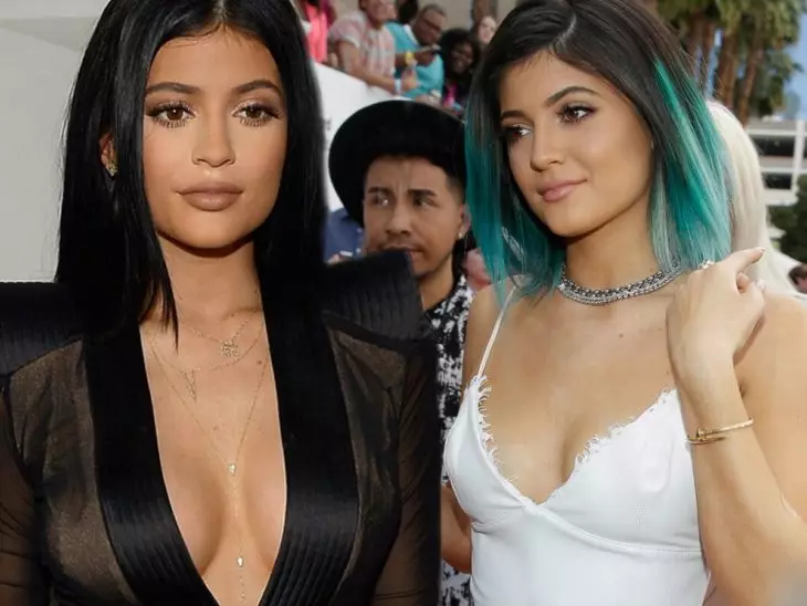 Glasine o poslu s grudima Kylie Jenner od strane najboljeg plastičnog hirurga 10786_2