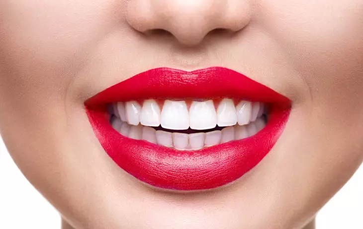 Як отримати здорову білосніжну посмішку за допомогою вінірів 10813_7