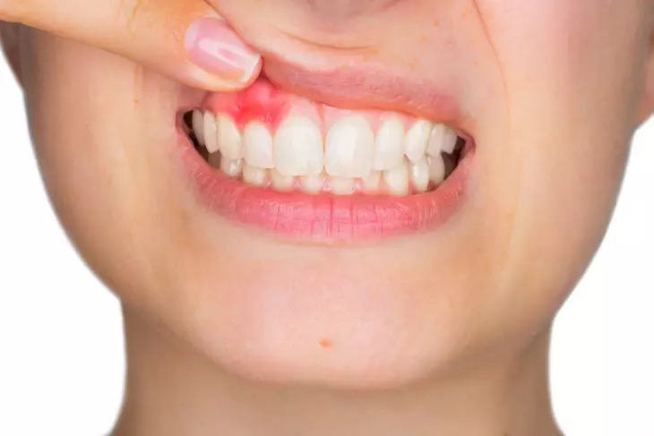 Upprätthålla friska tandkött och tänder utan tandläkare 2022 10814_2