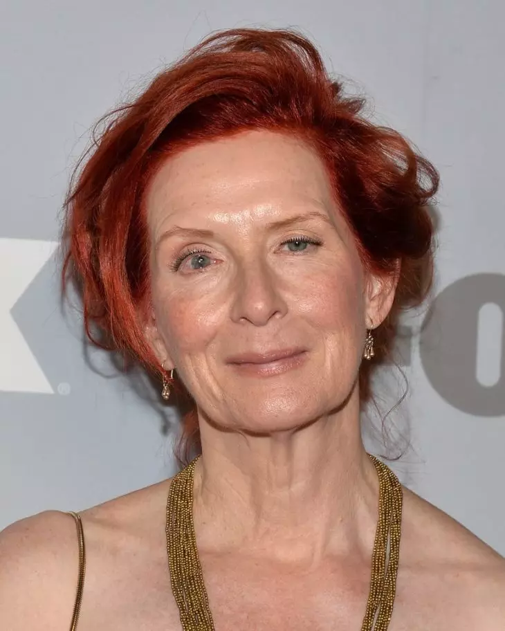 Frances Conroy – เกิดอะไรขึ้นกับดวงตาของนักแสดง AHS? 12884_4