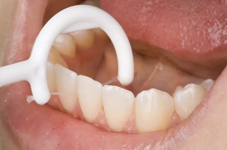 Hampaiden puhdistuksen perustarvikkeet – kaikki mitä sinun tarvitsee tietää 13045_1