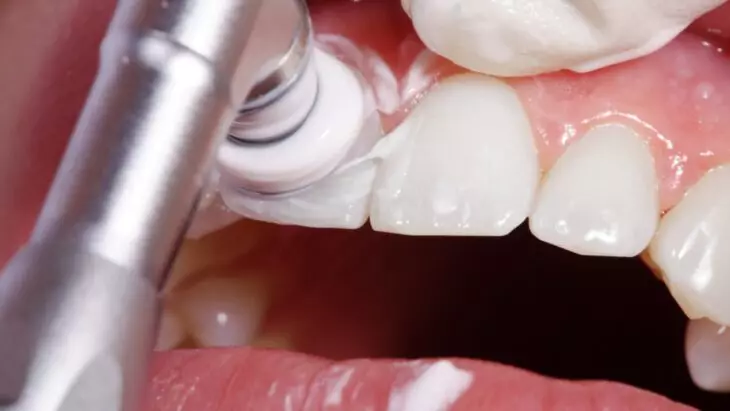 Esenciales de limpieza dental: todo lo que necesita saber 13045_4