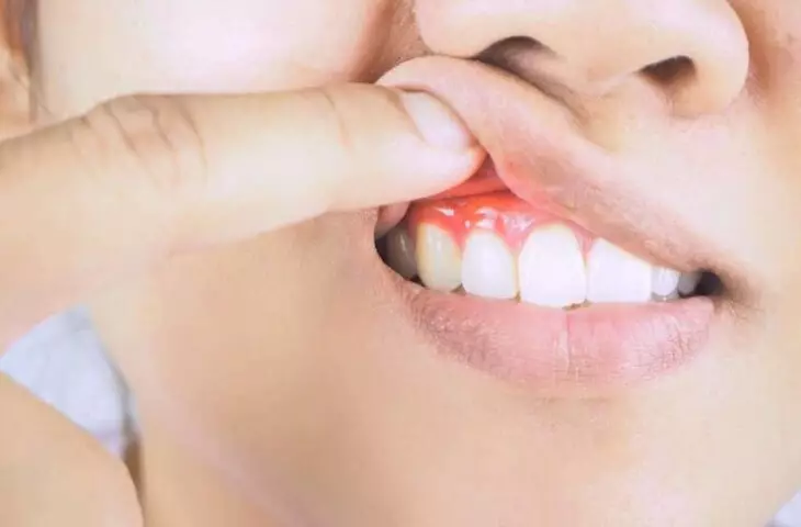 Hampaiden puhdistuksen perustarvikkeet – kaikki mitä sinun tarvitsee tietää 13045_5