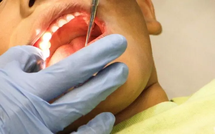 Esenciales de limpieza dental: todo lo que necesita saber 13045_6