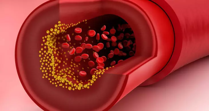 Ọrọ Ọmọbinrin: Aṣiri Mi Lati Ipadanu iwuwo? Cholesterol ti o ga! 13221_3