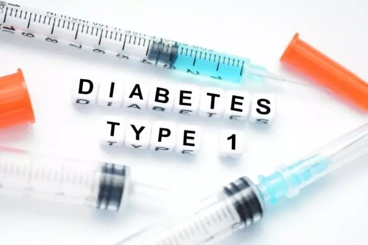 Zizindikiro za 5 za Type 1 Diabetes Azimayi Ayenera Kudziwa 13585_1