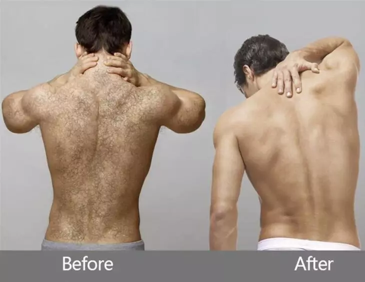 7 Pro Tip para sa Electric Back Hair Shaver ng Lalaki - Lahat ng Kailangan Mong Malaman 14769_3