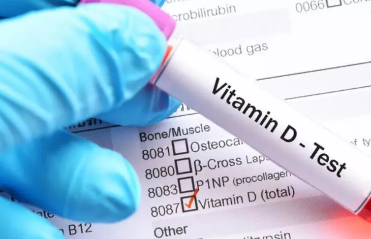 Hoe lang duurt het om vitamine D-tekort te corrigeren? 15242_2