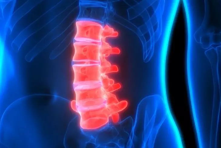 Como afectan as lesións da medula espiñal ao cerebro: opcións de diagnóstico e tratamento 16342_2