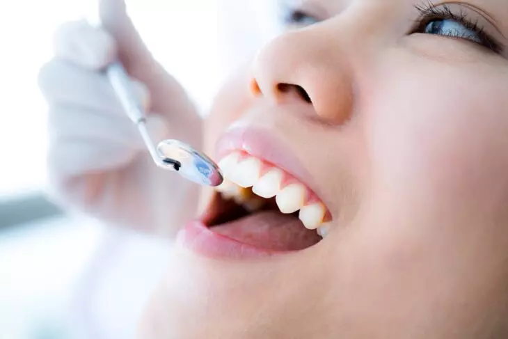 8 vantaggi dei primi trattamenti ortodontici per bambini - Guida 2022 16631_1
