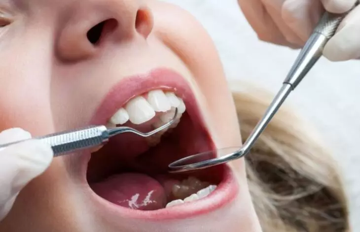 8 vantaggi dei primi trattamenti ortodontici per bambini - Guida 2022 16631_7