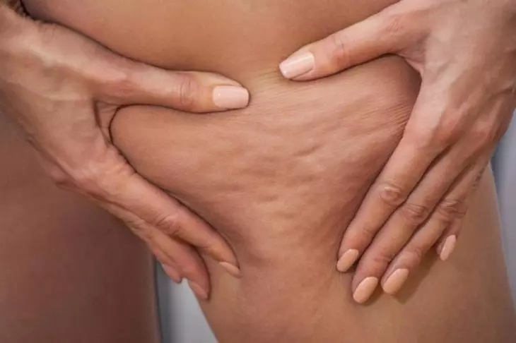 Nri 5 kacha elu na mgbakwunye maka ahụike Cellulite na akpụkpọ ahụ 16737_1