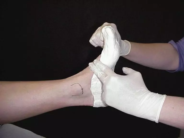 Saznajte više o prilagođenim ortopedijama za stopala 17122_1