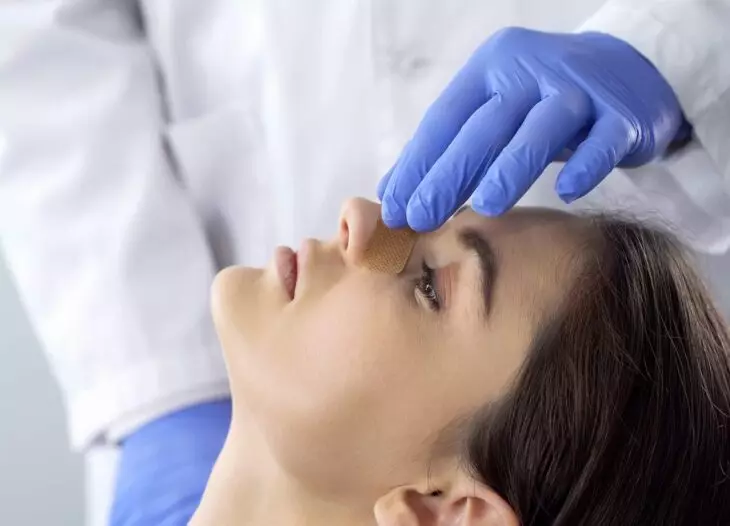 Rinoplastika əməliyyatından sağalmaq üçün nə qədər vaxt lazımdır? 1736_2