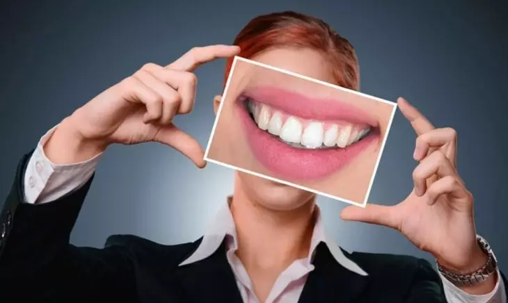 האם אתה מועמד לרפואת שיניים קוסמטית? 19121_2