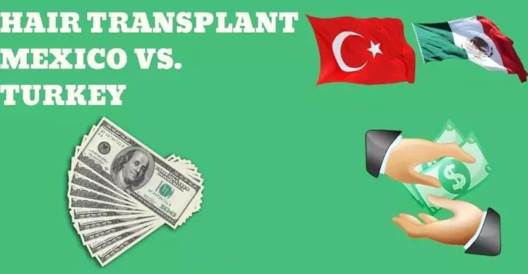 Transplante capilar en Turquía ou México: por que debes optar?