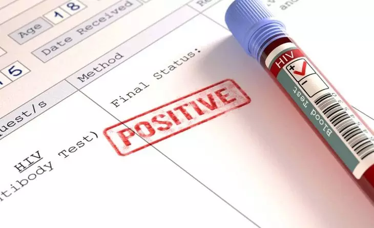 36 tinzen dy't ik hie nei it ûntfangen fan (falske) positive resultaten fan HIV-tests 22767_1