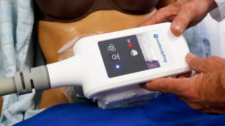 Kedu ihe bụ CoolSculpting na ị kwesịrị ịhọrọ ya? 22900_2