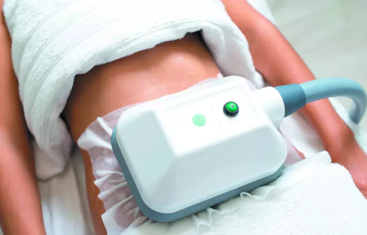 Kas yra „CoolSculpting“ ir ar turėtumėte tai pasirinkti? 22900_3