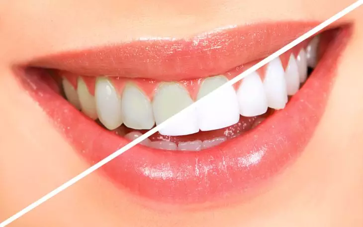Die 5 besten Produkte für die Zahnpflege Ihrer Familie – Leitfaden 2022 23266_5