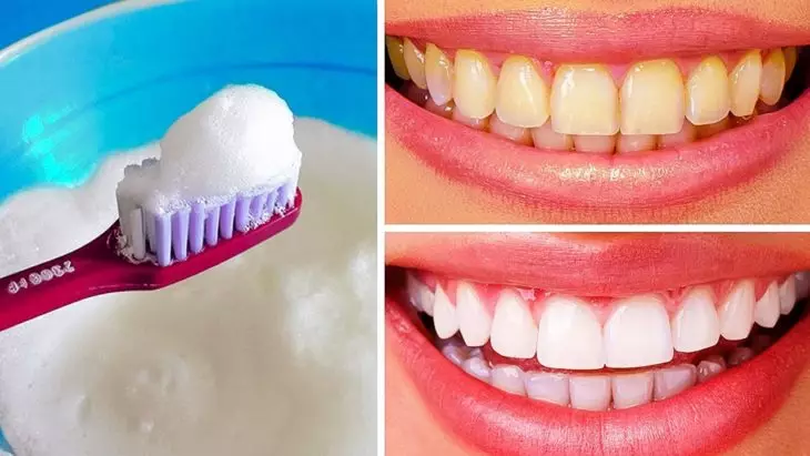 Állítsa vissza tökéletes mosolyát – Hogyan fehérítse fogait 25066_1