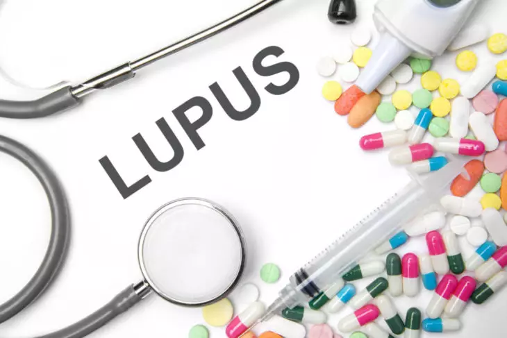 مەندە Lupus بار 26510_2