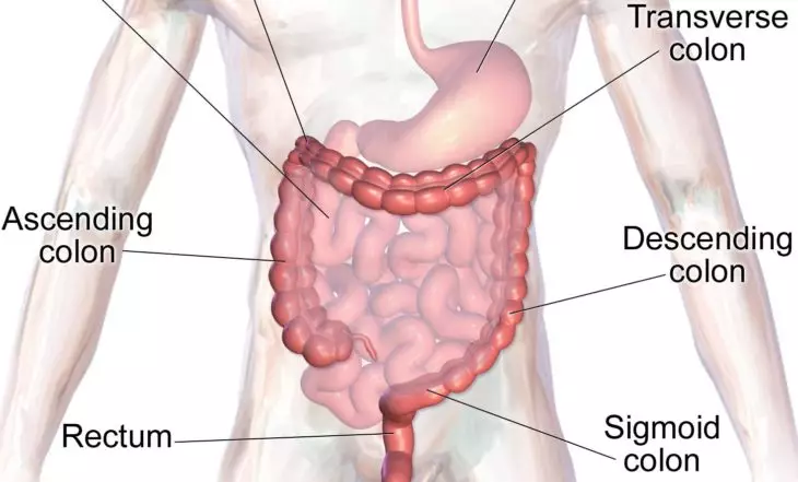 E i ai O'u … Ma'i Irritable Bowel 26511_2