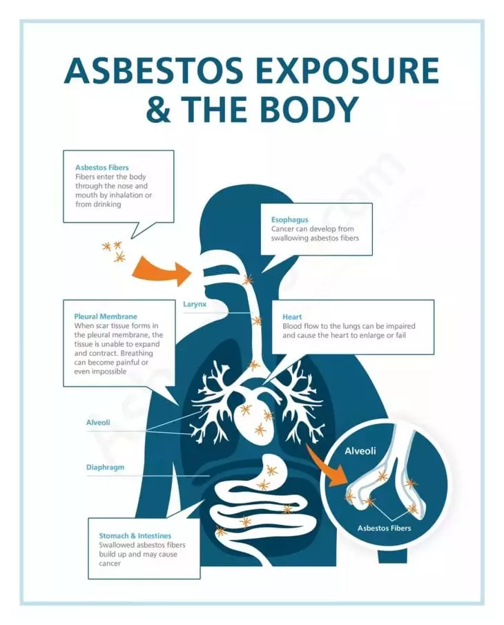 Asbest məruz qalmasının sağlamlıq riski nədir 26909_2