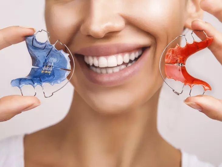 4 coses que cal saber abans de comprar retenidors dentals en línia - Guia 2022 2696_5