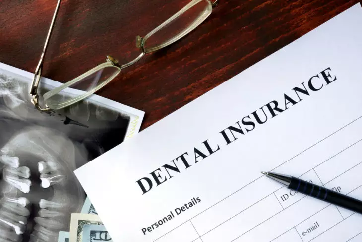 Gdzie uzyskać niedrogie plany płatności za implanty dentystyczne w 2022 roku? 27719_3