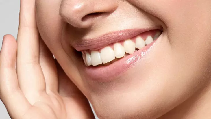Kuinka saada täydelliset valkoiset hampaat kuten julkkikset 29785_1