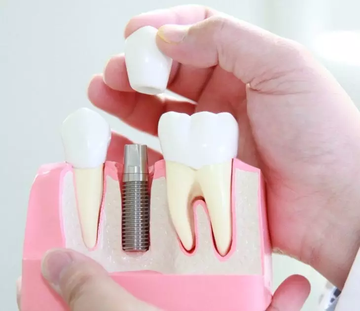 Šta je stomatolog i kako vam on može pomoći 32597_1