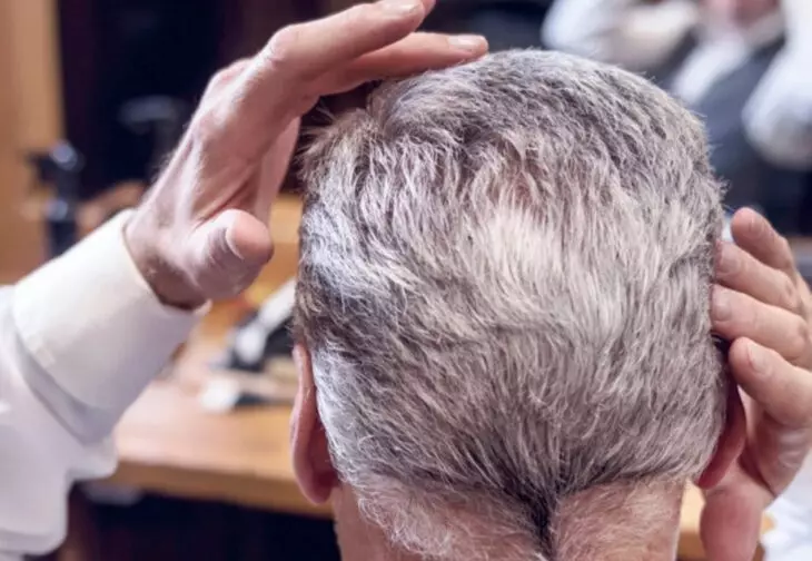 Los 8 mejores tratamientos anticaída del cabello para hombres en 2022 331_2