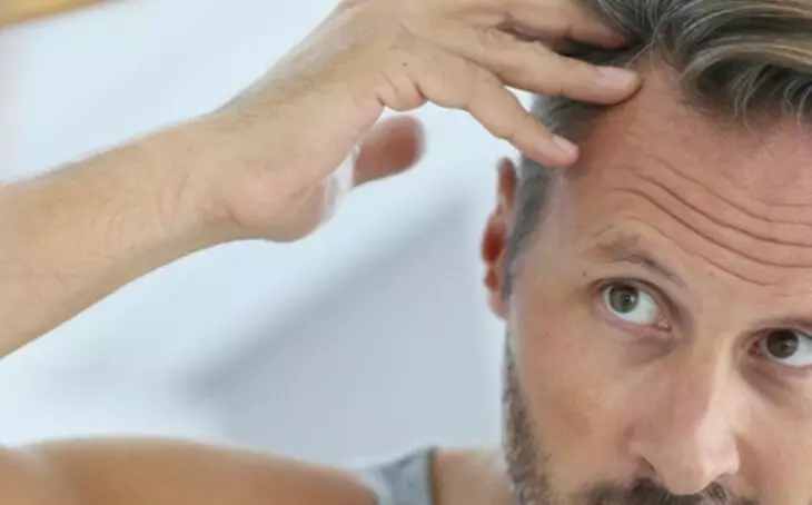 2022 में पुरुषों के लिए 8 सर्वश्रेष्ठ बालों के झड़ने का उपचार 331_6
