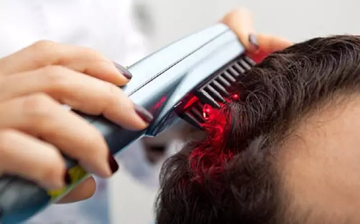 Los 8 mejores tratamientos anticaída del cabello para hombres en 2022 331_8