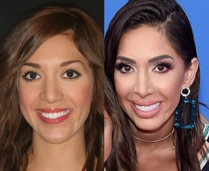 Onherkenbaar – Aanhangers wil hê Farrah Abraham moet ophou met plastiese chirurgie 34245_1