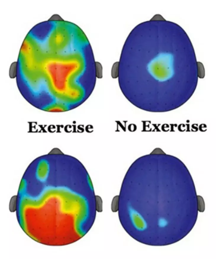 Упражнението може да бъде важно лечение за ADHD 35638_1