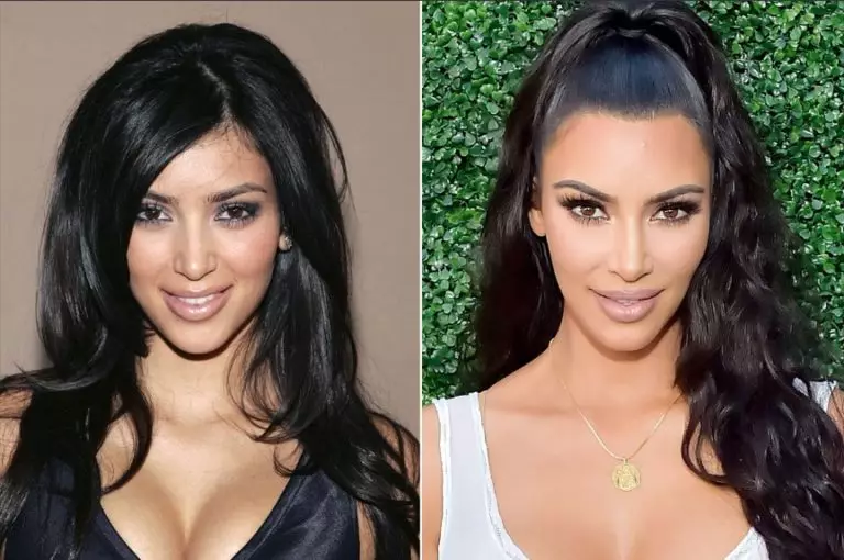 Kim Kardashian Nose රැකියා කටකතා නැවතත් ආරම්භ වේ 3655_1