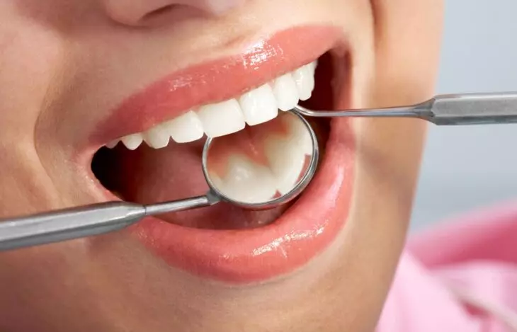أهم 5 فوائد لرؤية أخصائي علاج جذور الأسنان 3771_2