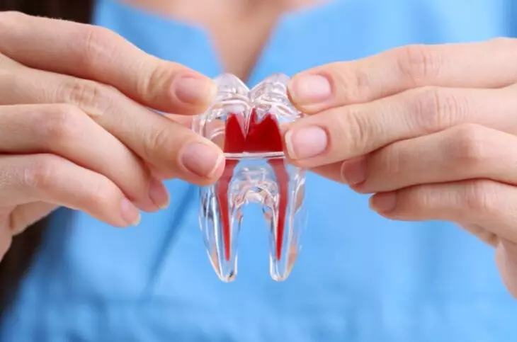5 Manfaat Teratas Menemui Endodontis 3771_4