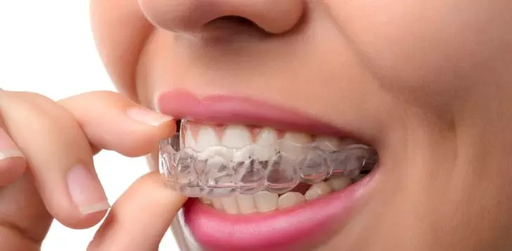 أشهر علاجات تقويم الأسنان للمشاهير 38004_3