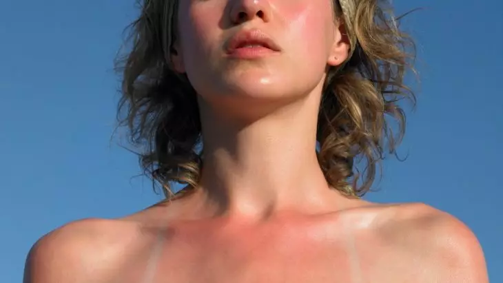 या उन्हाळ्यात तुम्हाला सूर्य आणि तुमच्या त्वचेबद्दल 9 गोष्टी माहित असणे आवश्यक आहे 39018_2