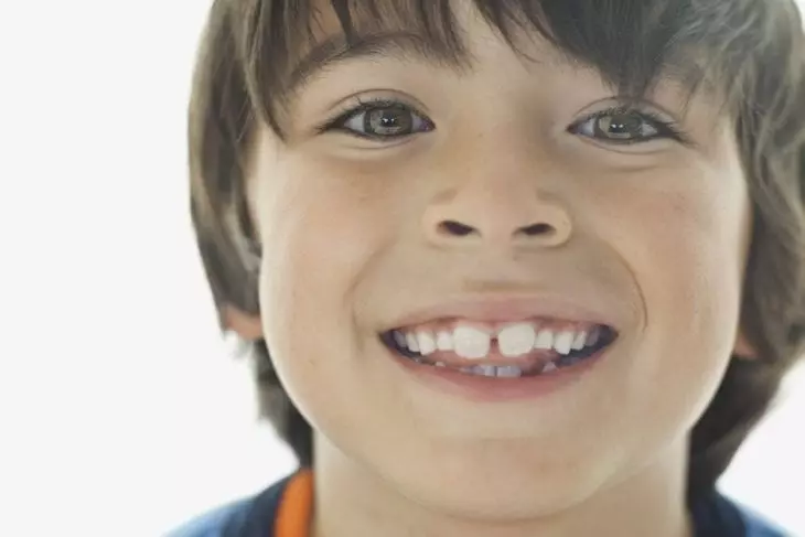 5 consells per prevenir les dents tortes en els nens 39671_1
