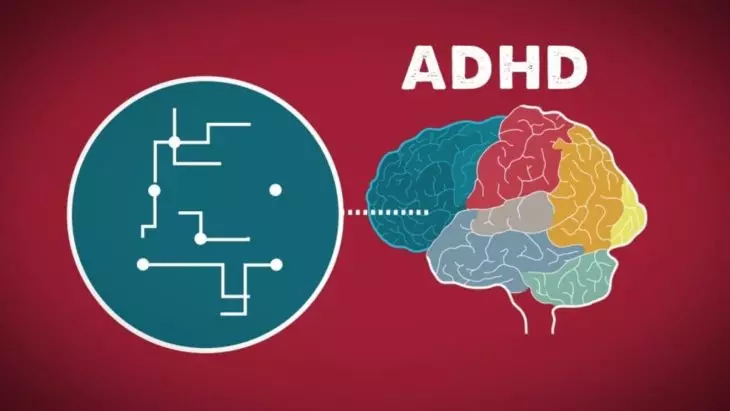 ADHD کیا ہے اور ماہرین اطفال کیسے مدد کرتے ہیں۔ 40470_2