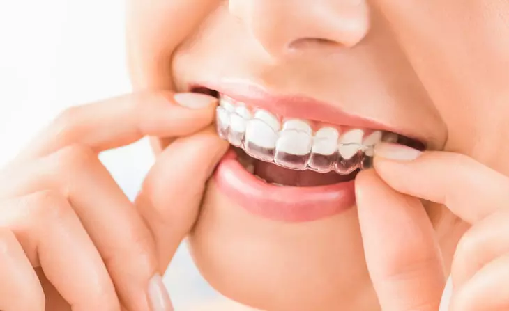 12 Inonyanya Kuzivikanwa Dental Procedures 40480_5