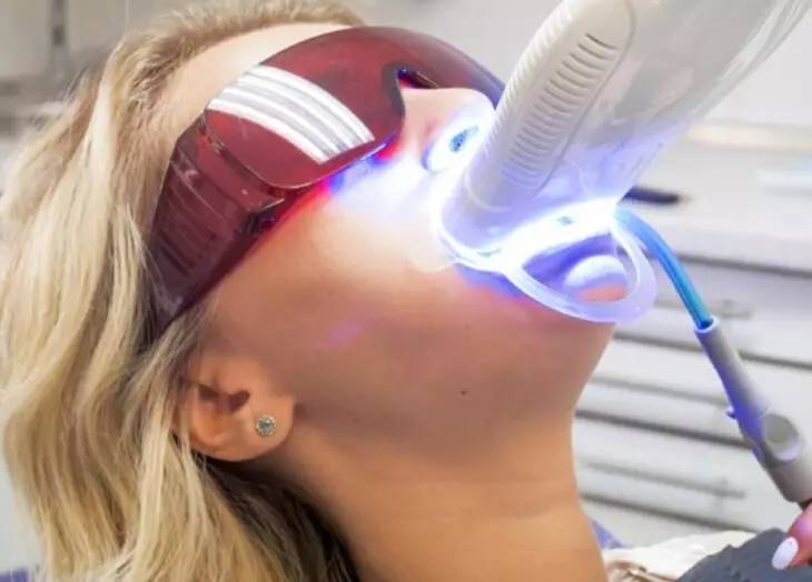 3 des dernières technologies en dentisterie esthétique 4095_8