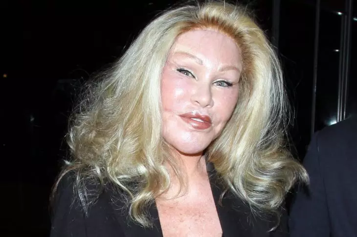 Top 5 Celebs Plastic Surgeries Failures 4273_3